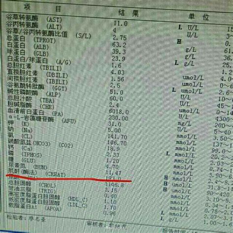 由病例探讨FK506浓度对肾功能的影响 医联