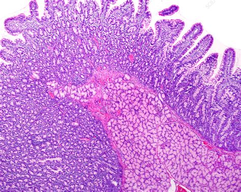 Brunner Glands In Duodenum Light Micrograph Stock Image C059 3792