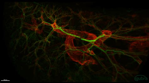 Multimodal 3d Mouse Brain Atlas Framework With The Skull Derived Coordinate System Gubra