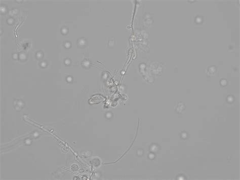 Yeast Cellwiki Yeast Cellwiki