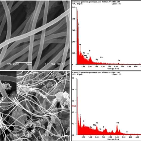 Scanning Electron Microscopy And Elemental Analysis By Eds Of