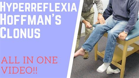 Hyperreflexia Clonus And Positive Hoffmans Sign Youtube