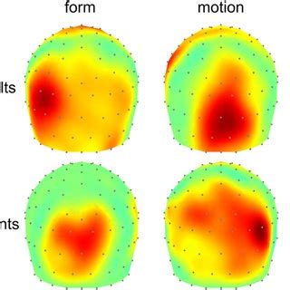 Event Related Potential Scalp Topography Group Analysis Of Adult Top