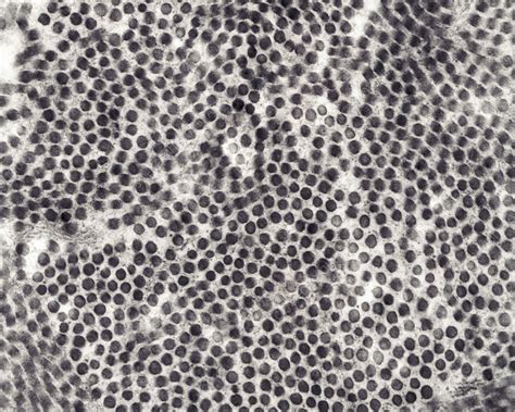 Collagen Fibrils Tem Stock Image C059 3646 Science Photo Library