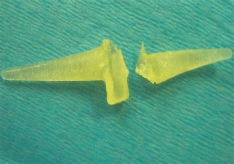 Abbreviations MCP Metacarpophalangeal Joint RA Rheumatoid Arthritis Download Scientific