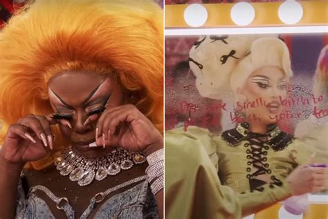 “drag Race” Star Onya Nurve Tearfully Reveals Dental Condition After