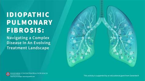 An Update On Idiopathic Pulmonary Fibrosis Zvrzg