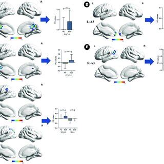 Anterior Cingulate Cortex Subregions Functional Connectivity In Download Scientific Diagram