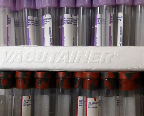 Vacutainer JungleKey Fr Image