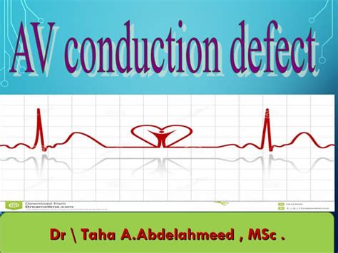 Lecture On Av Conduction Defect Of Heart Ppt