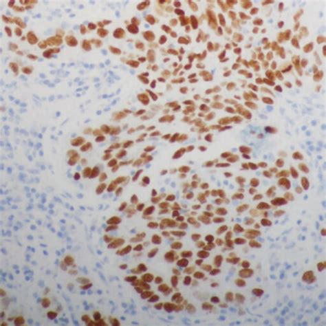 Xiaojun Wu Medical Doctor Johns Hopkins Medicine Maryland Jhusom