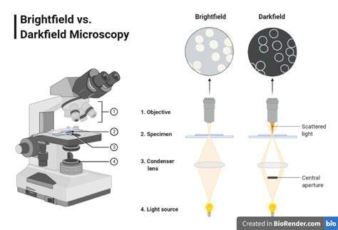 Dark Field Microscopy Principle And Uses • Microbe Online