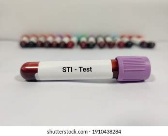 Test Tube Blood Sample Sti Sexually Stock Photo Shutterstock