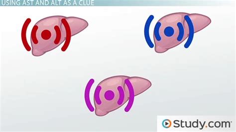 AST ALT Levels In The Liver Definition Significance Tests Lesson Study Com