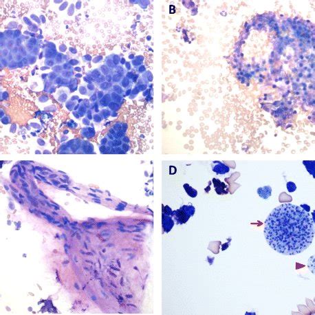 Examples Of Cases That Flow Cytometry Analysis Was Canceled Based On Download Scientific