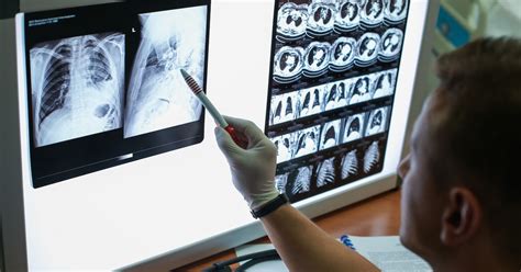Qué Es La Fibrosis Quística Síntomas Y Tratamiento Infobae