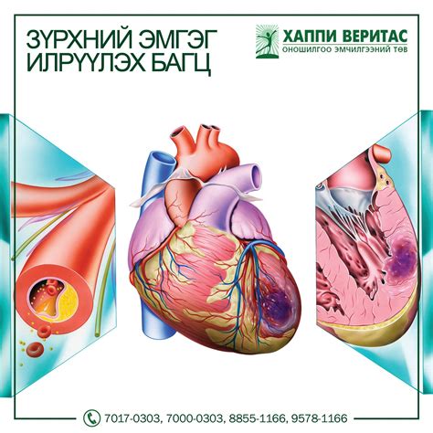 Шинэ багц Зүрхний эмгэг илрүүлэх багц Лабораторийн шинжилгээ 1 Зүрх судасны биохими T Cho