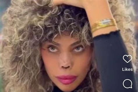 תמונות קשות איך רומי אברגיל נראית אחרי המשבר הבריאותי For Real