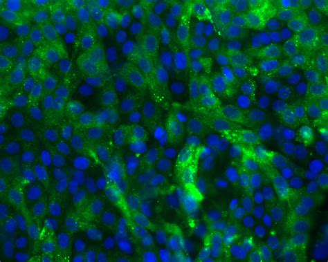 Hepatocyte Differentiation Zakian Lab Ipsc Collection