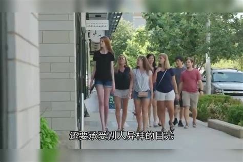 4个世界上最长的人体器官，看完惊呆了，你知道几个？