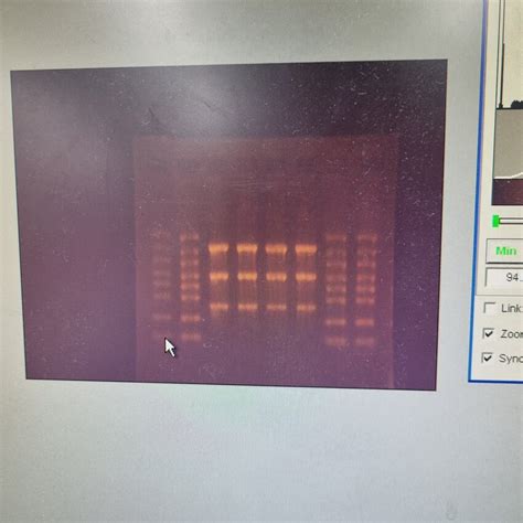I Cant Understand My Rna Gel Electrophoresis Why My Result Have Small