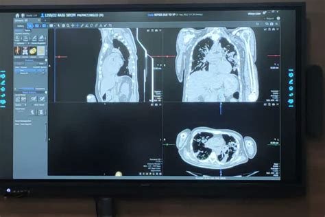 જાતા જાતા પણ દેશને કામ આવ્યા રાજૂ શ્રીવાસ્તવ જાણો એવું તો શું કરી ગયા Comedian Raju Srivastava