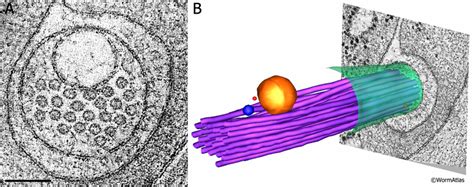 Electron Tomography Overview