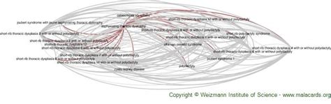 Asphyxiating Thoracic Dystrophy Disease Malacards Research Articles