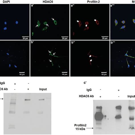 Profilin 2 Interaction With Hdac6 Interaction Between Hdac6 And Download Scientific Diagram
