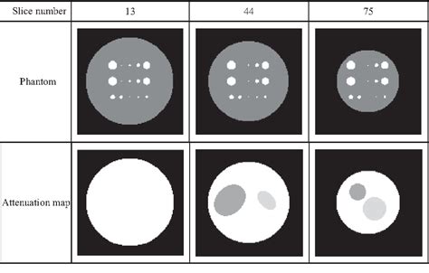 Figure 5 From Analytical Cone Beam Spect Reconstruction Algorithm With Non Uniform Attenuation
