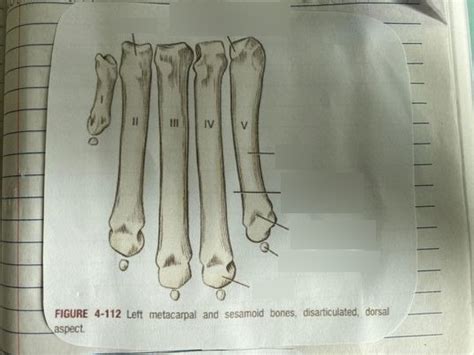 No 14 1 Left Metacarpal And Sesamoid Bones Disarticulated Dorsal Aspect Diagram Quizlet
