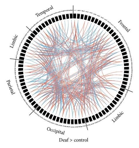 Group Differences Of Brain Functional Connectivity Between Prelingually