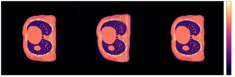 transverse cross section of the cbct reconstruction made a using sart