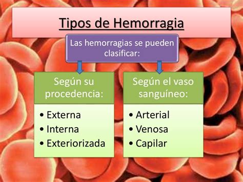 Hemorragia Externa