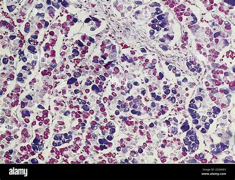 Figure 1 17 Histology Of The Normal Pituitary In Tumors Of The