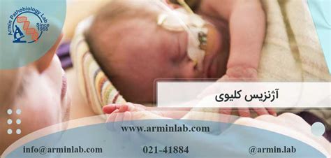آژنزیس کلیوی آزمایشگاه آرمین بیماری های گوارشی سرطان روده بزرگ