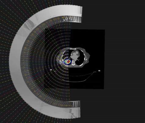 Proton Arc Therapy Do We Need It Can We Deliver It Physics World