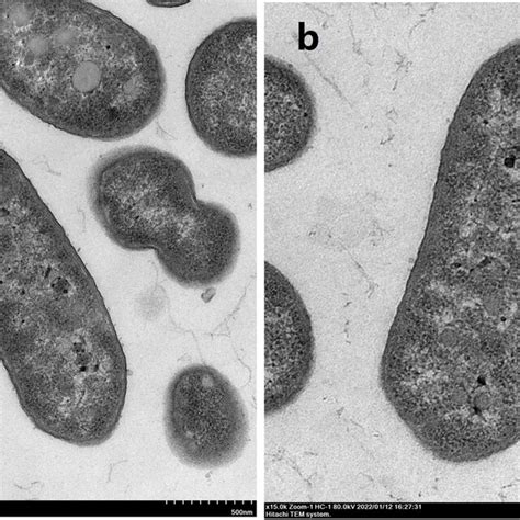 Transmission Electron Micrographs Of The Cellular Morphology Of Download Scientific Diagram