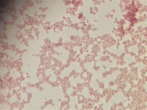 Microbiology Mania Endospore And Capsule Staining Lab 5 May 18 2015