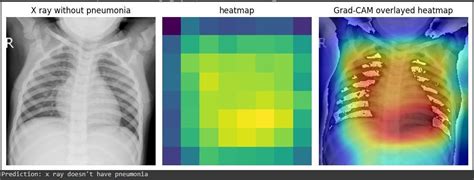 Namedparameters Grad