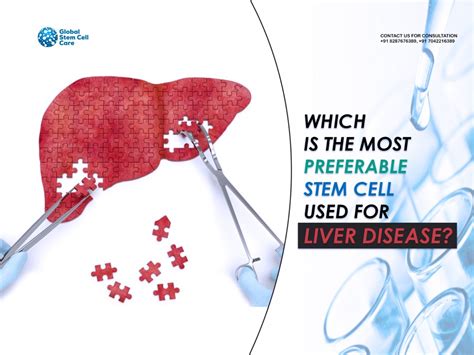 Liver Disease Archives Global Stem Cell Care