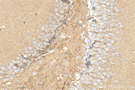Scn8a Antibody 28504 1 Ap Proteintech