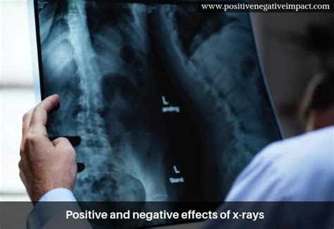 Positive And Negative Effects Of X Rays Side Effects