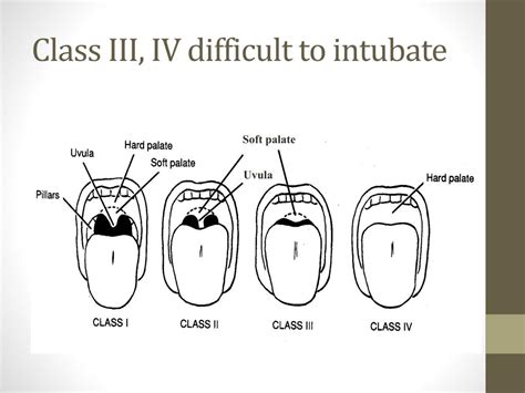 Ppt Endotracheal Intubation Powerpoint Presentation Free Download