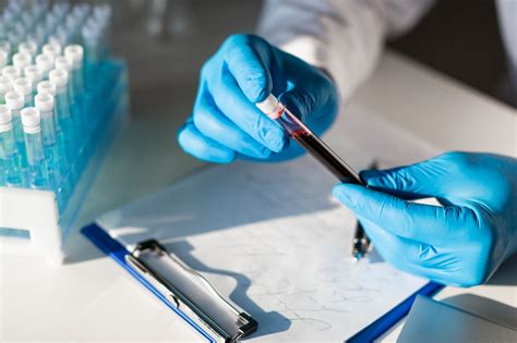 Microfluidic Sensors For Point Of Care Diagnostics