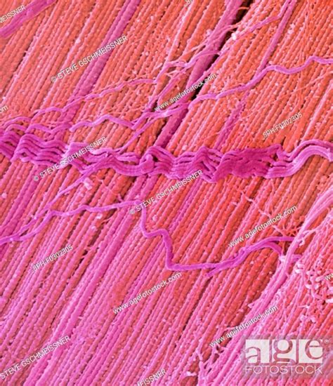 Tendon Coloured Scanning Electron Micrograph Sem Showing Bundles Of Collagen Fibres Stock