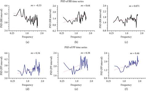 Power Spectral Analysis By Age Control Subjects N15 With Increasing