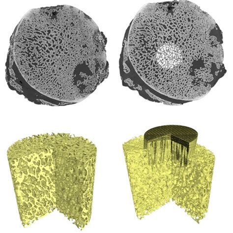 Micro Ct 3d Reconstruction Of Femoral Head Bone Samples A Before And Download Scientific