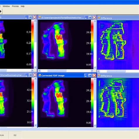 Pdf Software Tool For Portal Dosimetry Research