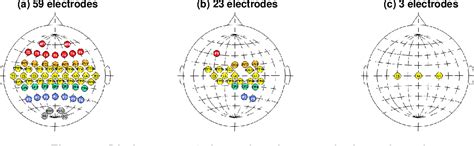 Figure 1 From Motor Imagery Eeg Data Augmentation With Cwgan Gp For Brain Computer Interfaces